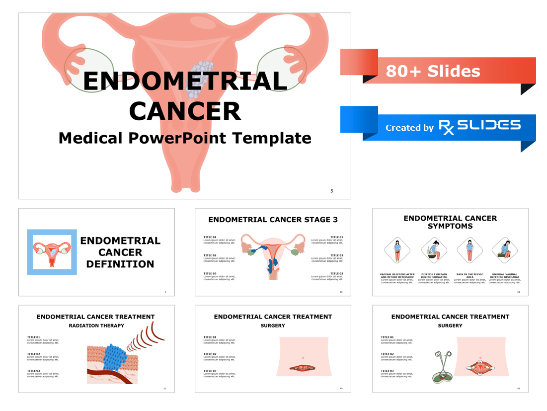 Download Endometrial Cancer PowerPoint Template| RxSlides